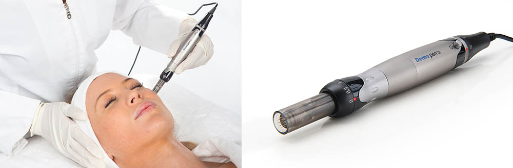 Dermapen Micro Needling - Services - Renew Skin Clinic